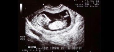 Les pathologies foetales - enceinte.com
