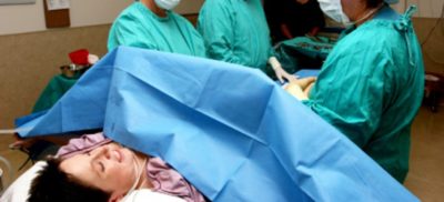 la césarienne itérative - La césarienne itérative les risques et avantages